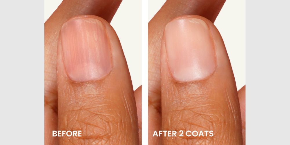 What Is Ridge Filler For Nails: Benefits and Uses | LONDONTOWN